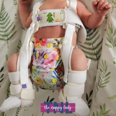 Do Cloth Nappies Damage Your Baby's Hips?